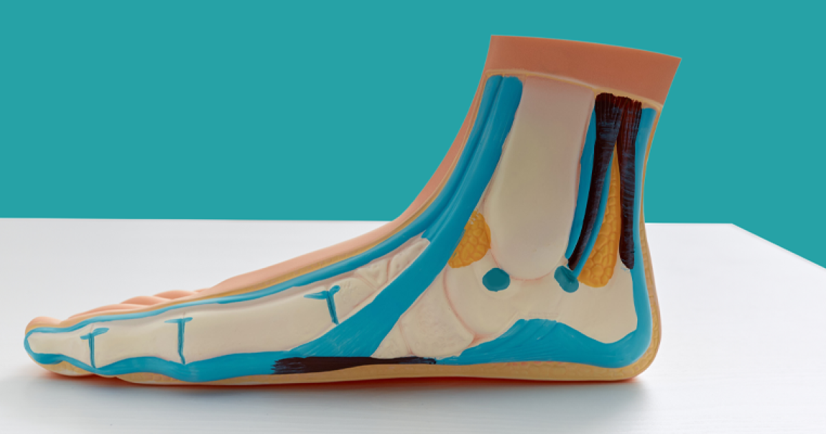 Plattfuß: Symptome, Behandlung und Folgen