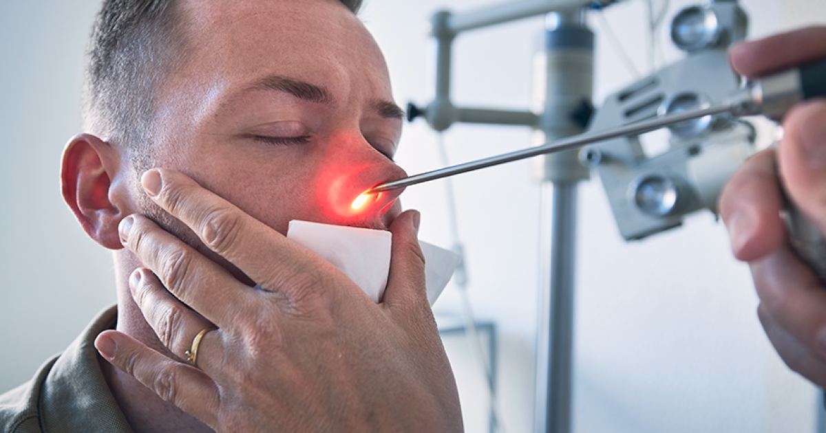 Nasenpolypen: Symptome und operative Behandlung