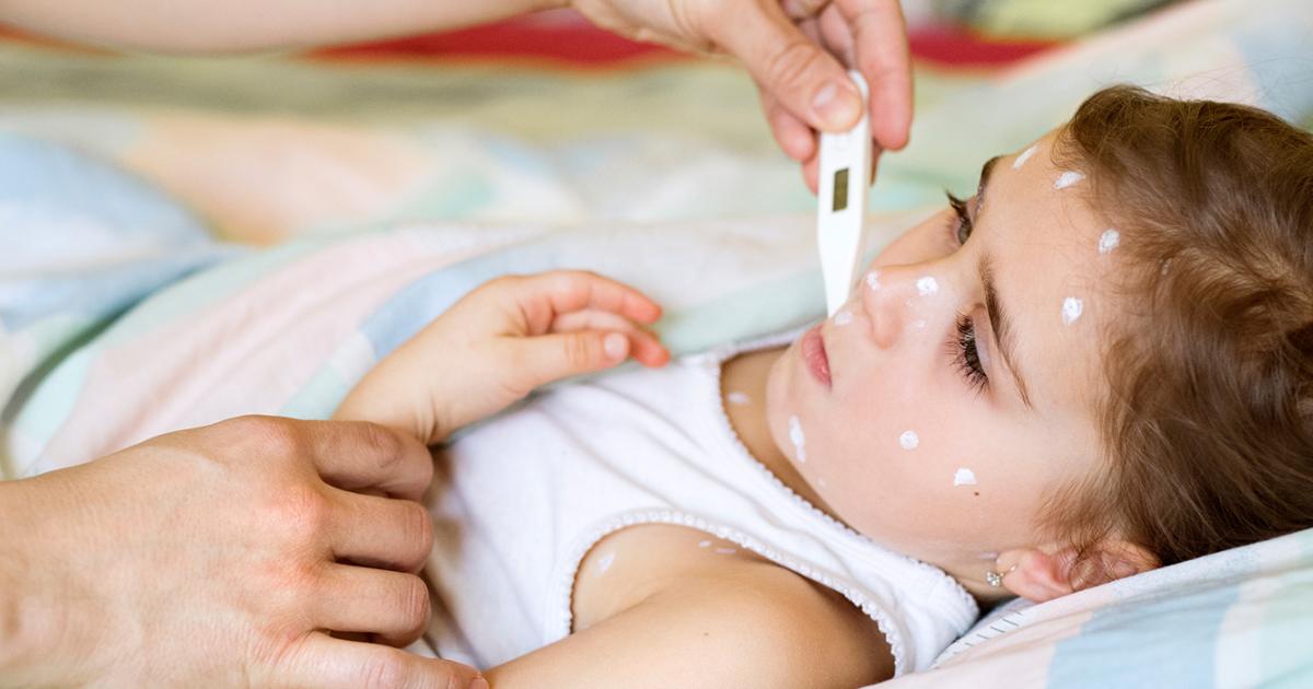 Windpocken: alles über Impfung und Symptome