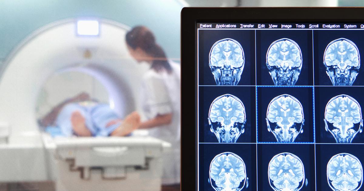 MRT: Funktionsweise und Untersuchungen