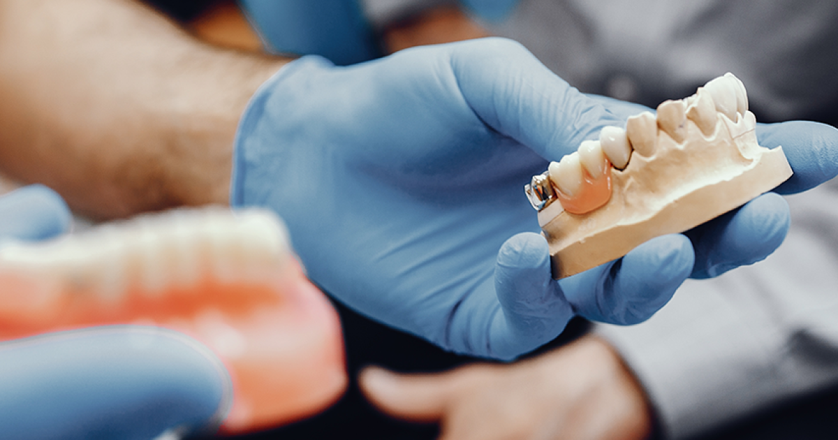 Welche Zahnprothesen gibt es und was kosten sie?
